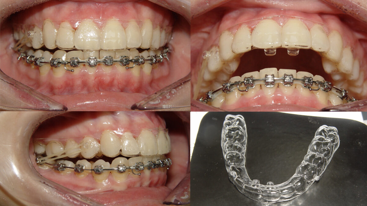 Damon Ultima 1 Year Programme - Borgan Academy