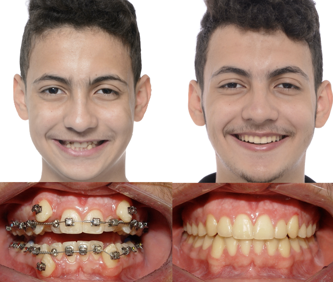 Damon Ultima 1 Year Programme - Borgan Academy